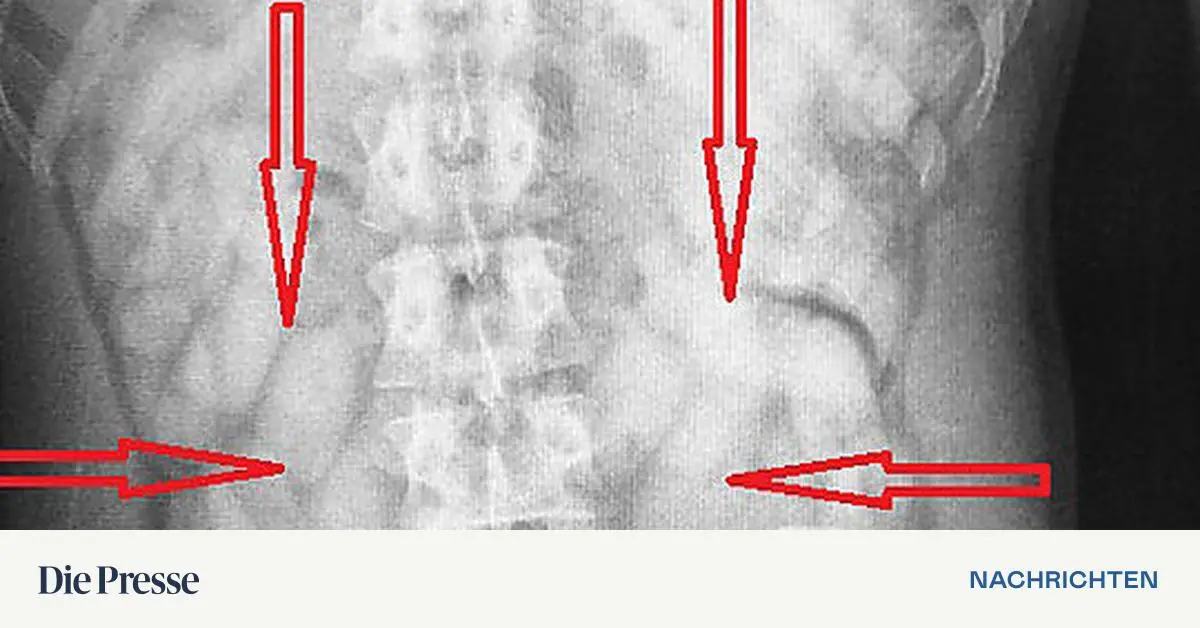 Schwechat: "Bodypacker" hatte 1,2 Kilo Kokain im Körper – DiePresse.com