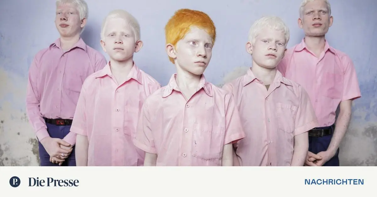 Albinismus: Zu hell, um unsichtbar zu sein | DiePresse.com